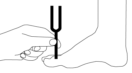Diabetic neuropathy - Screening | BMJ Best Practice US