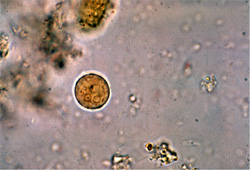 Amoebiasis - Symptoms, diagnosis and treatment | BMJ Best Practice